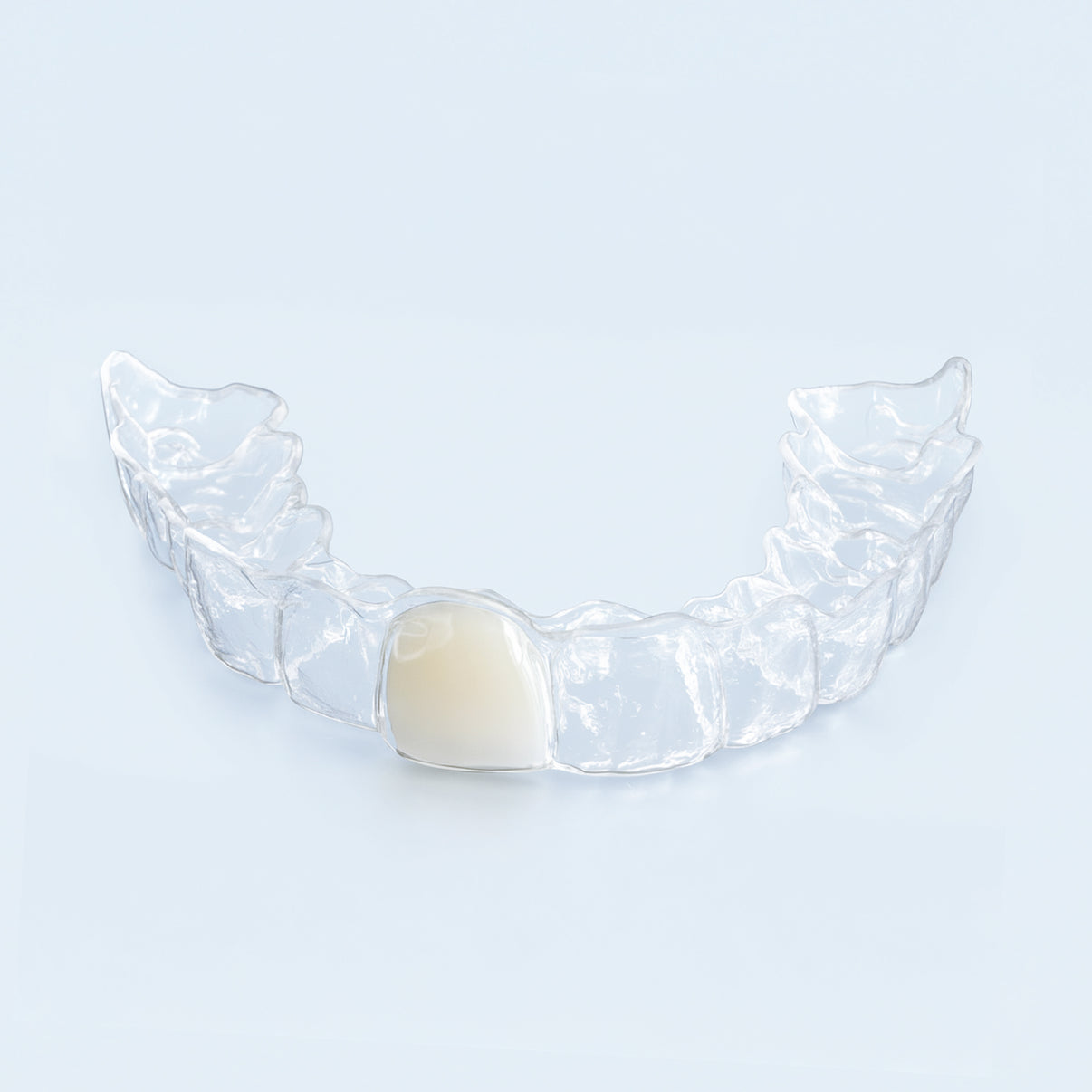 Missing Tooth Retainer, Instant Smile Fix | Venneir®